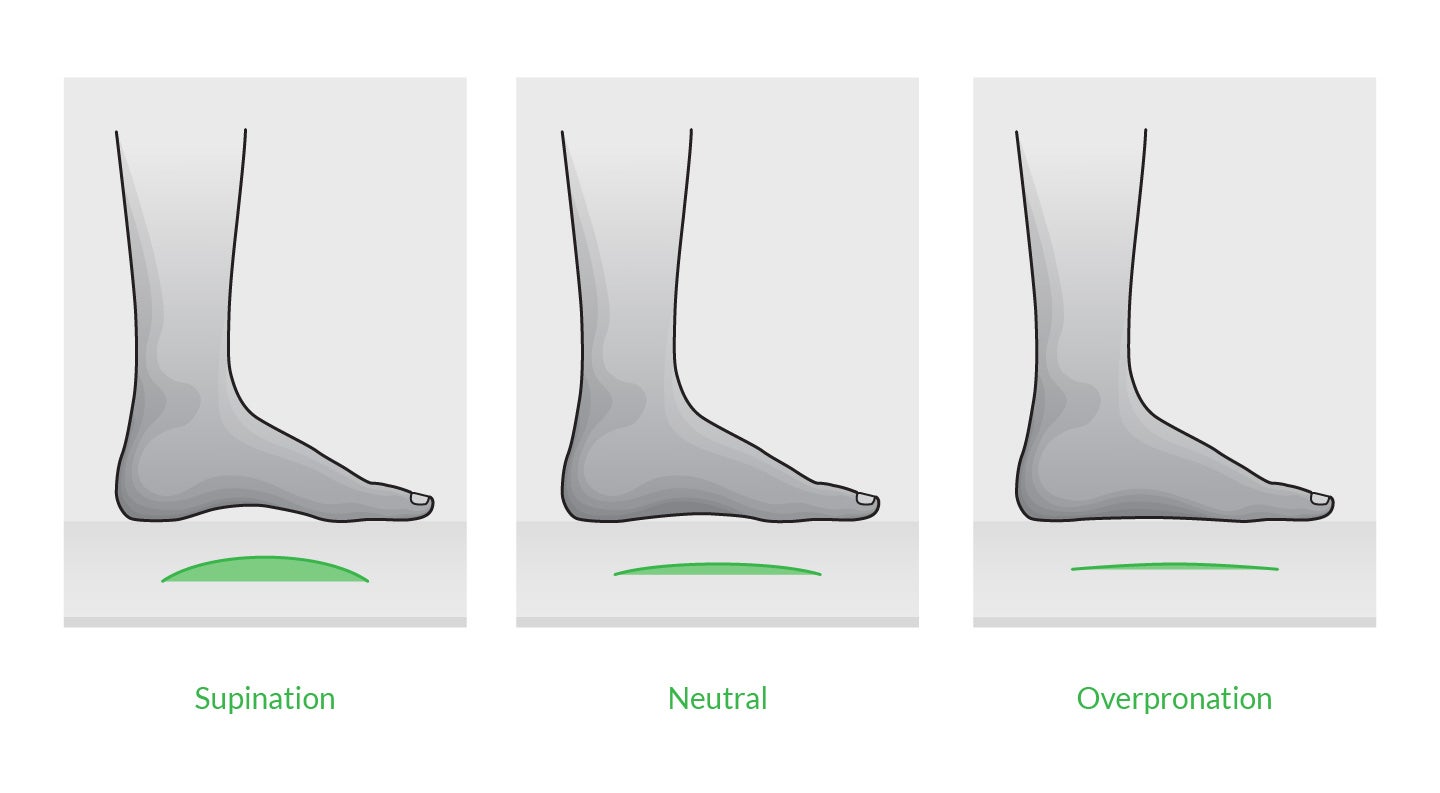 Pronation and How It May Affect Your Running